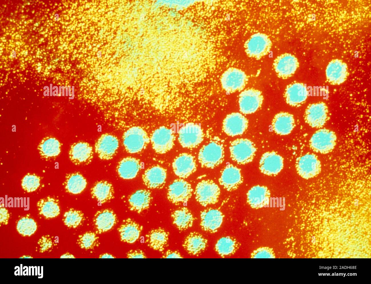 False colour transmission electron micrograph (TEM) of virions of the ...