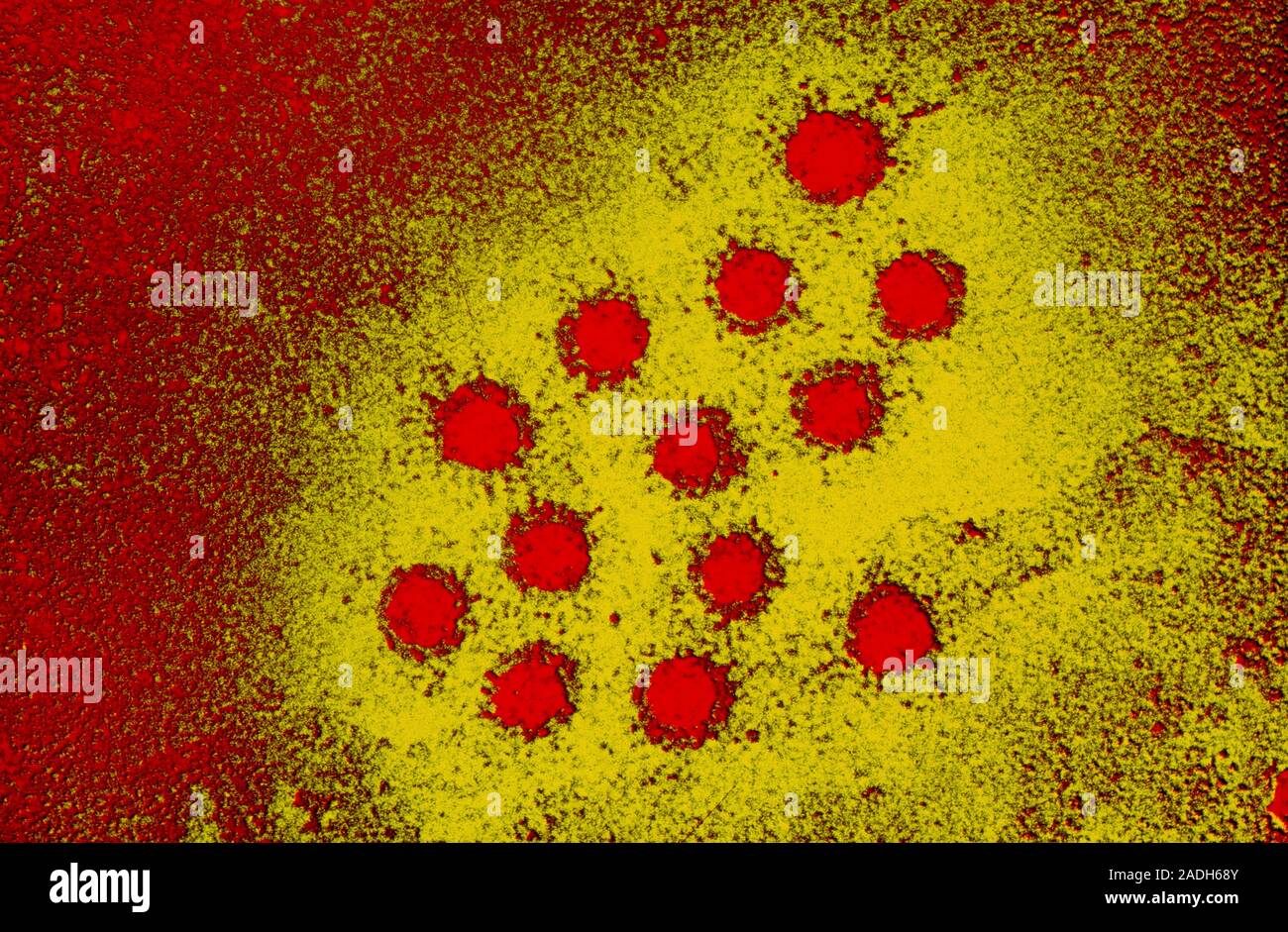 False colour transmission electron micrograph (TEM) of virions of the ...