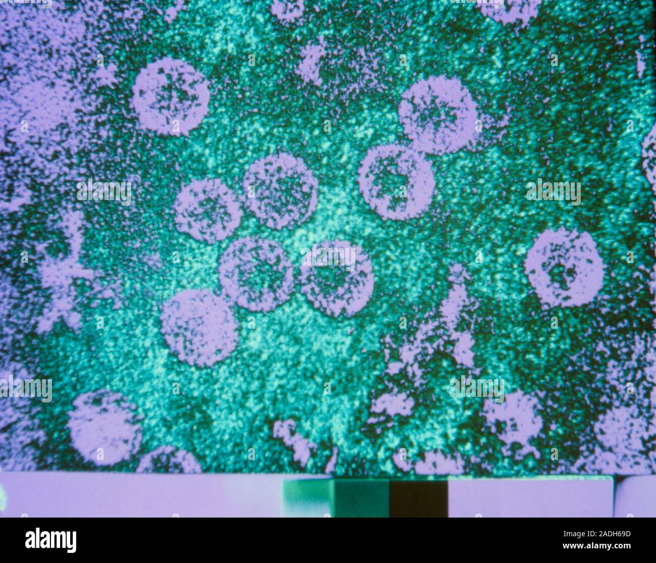 False-colour transmission electron micrograph (TEM) of hepatitis B ...