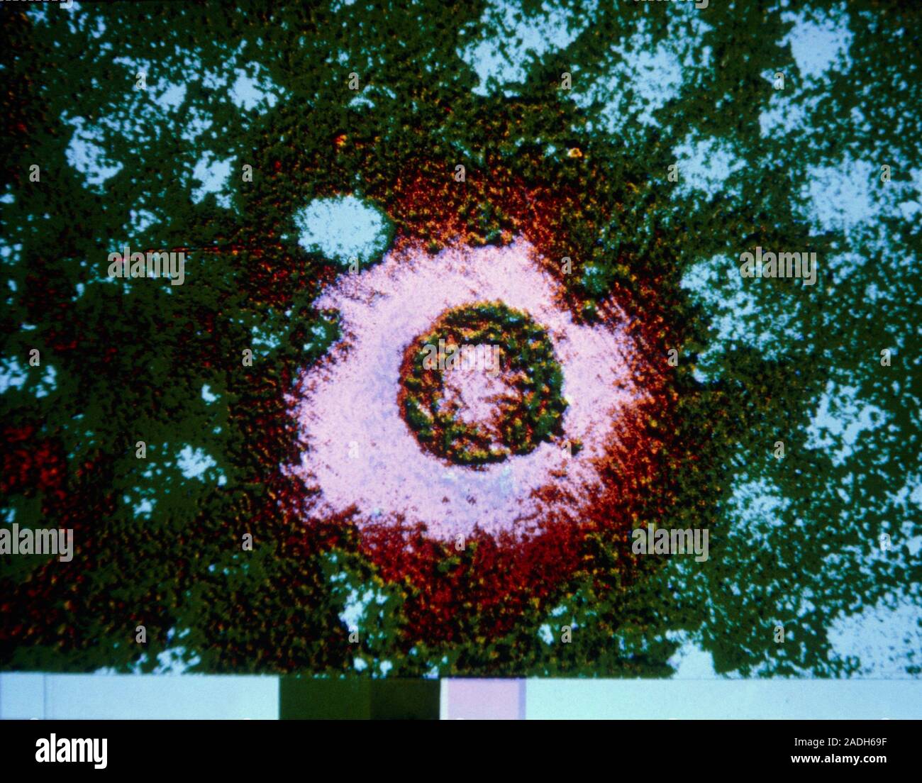 False-colour Transmission Electron Micrograph (TEM) of Hepatitis B ...