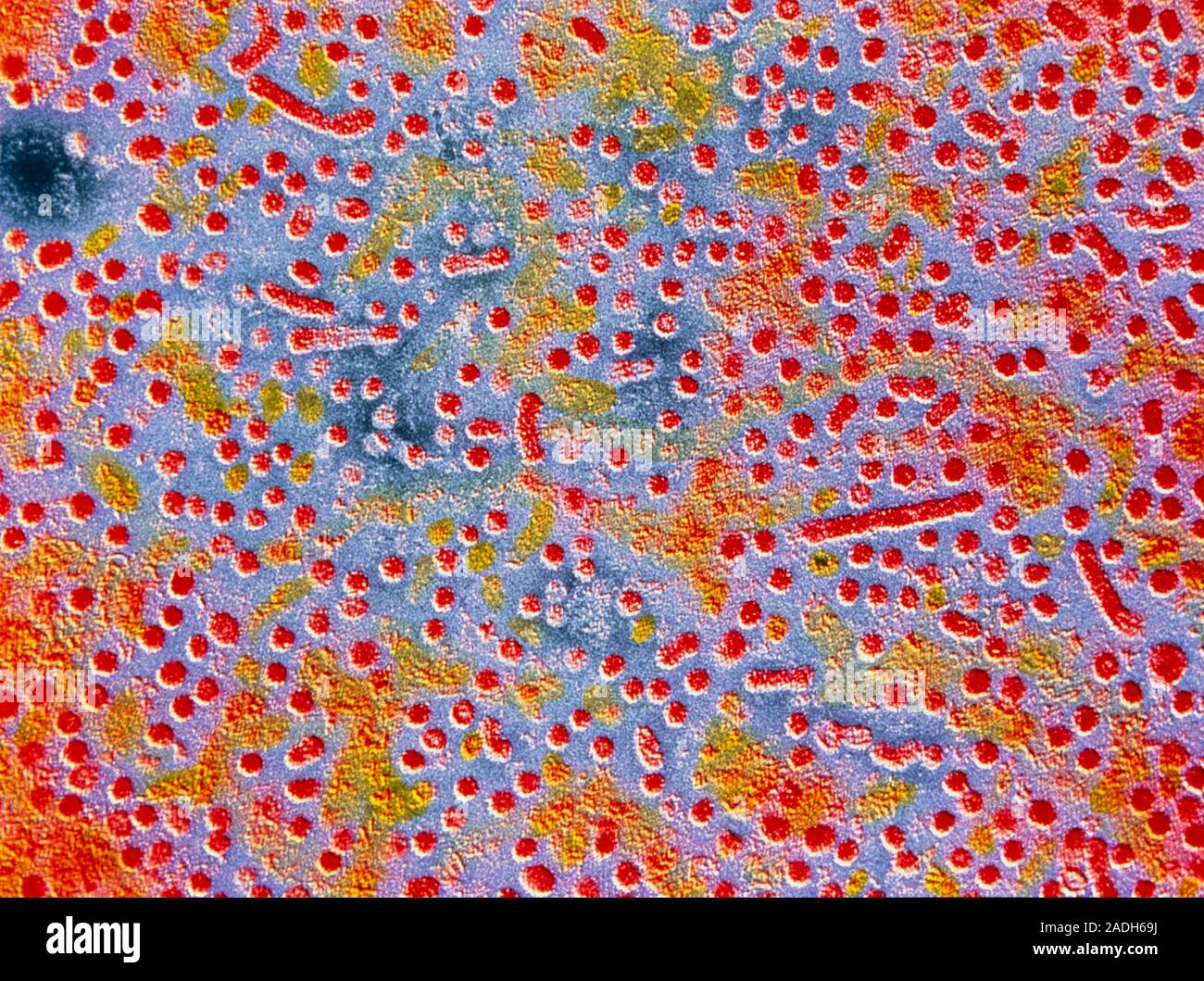 False-colour transmission electron micrograph of Hepatitis B virus ...