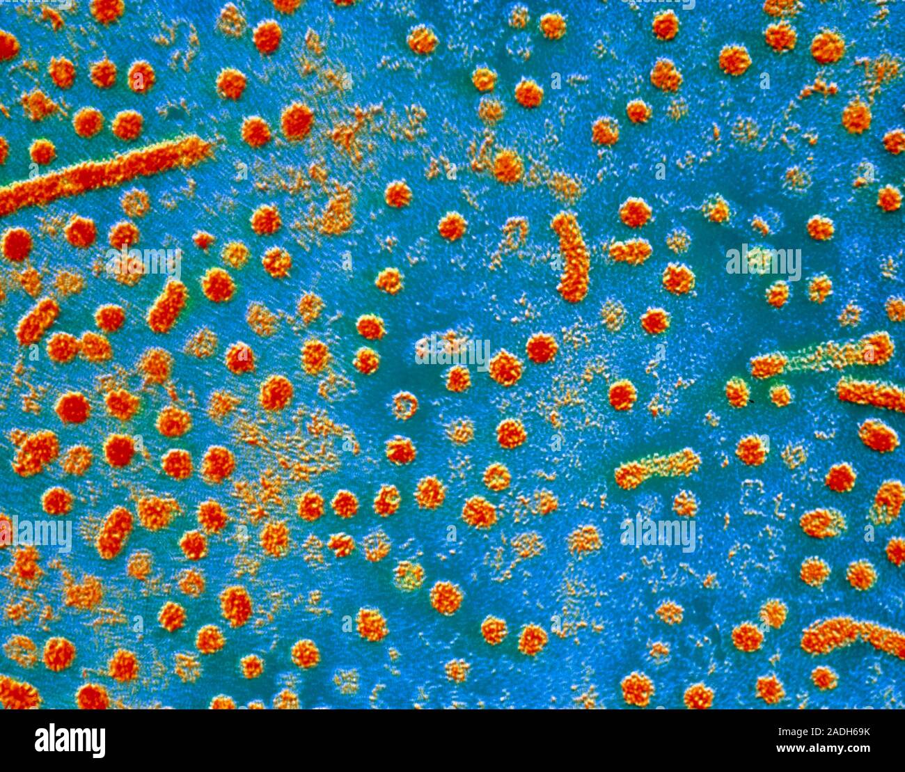 False-colour transmission electron micrograph of Hepatitis B virus ...