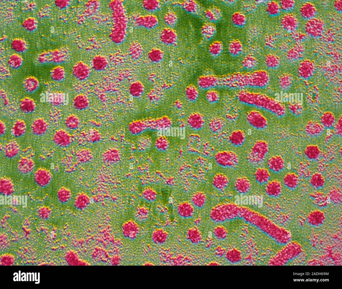 False-colour transmission electron micrograph (TEM) of Hepatitis B ...