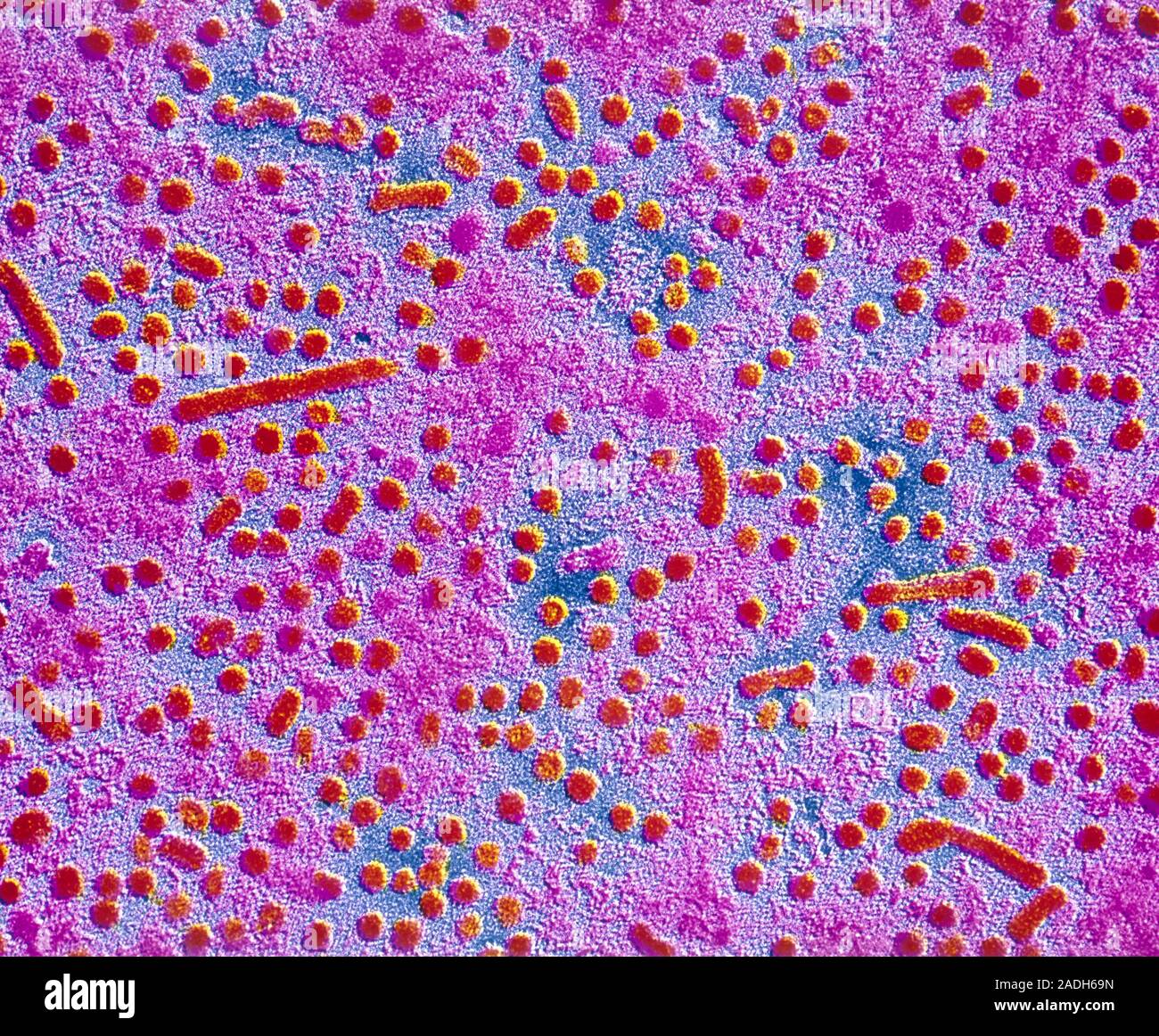 False-colour transmission electron micrograph of Hepatitis B virus (HBV ...