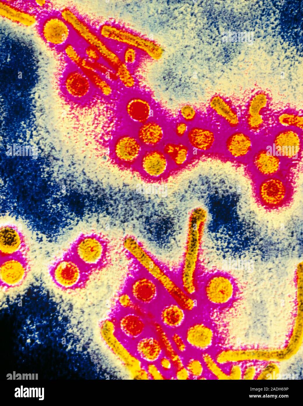 False-colour transmission electron micrograph (TEM) of Hepatitis B ...