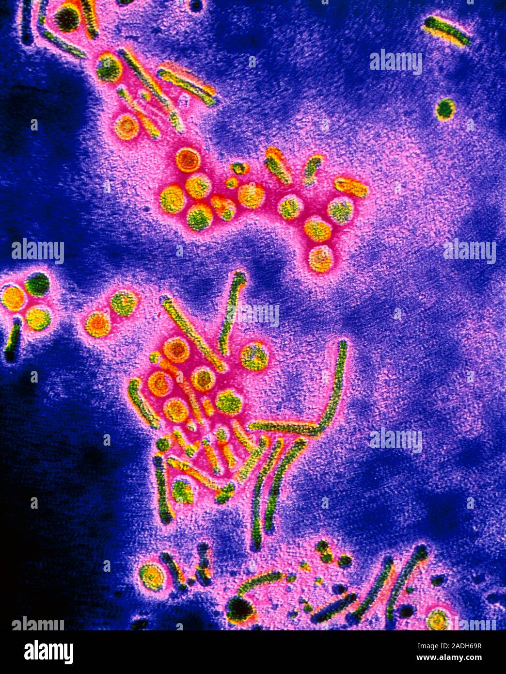 False-colour transmission electron micrograph (TEM) of the Hepatitis B ...