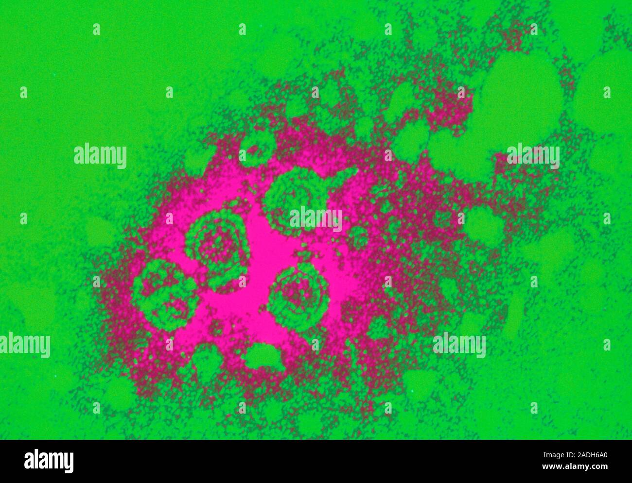 Hepatitis B virus. Coloured Transmission Electron Micrograph (TEM) of ...
