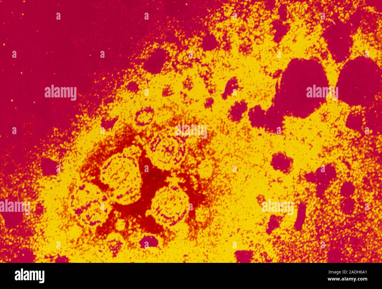 Hepatitis B virus. Coloured Transmission Electron Micrograph (TEM) of ...