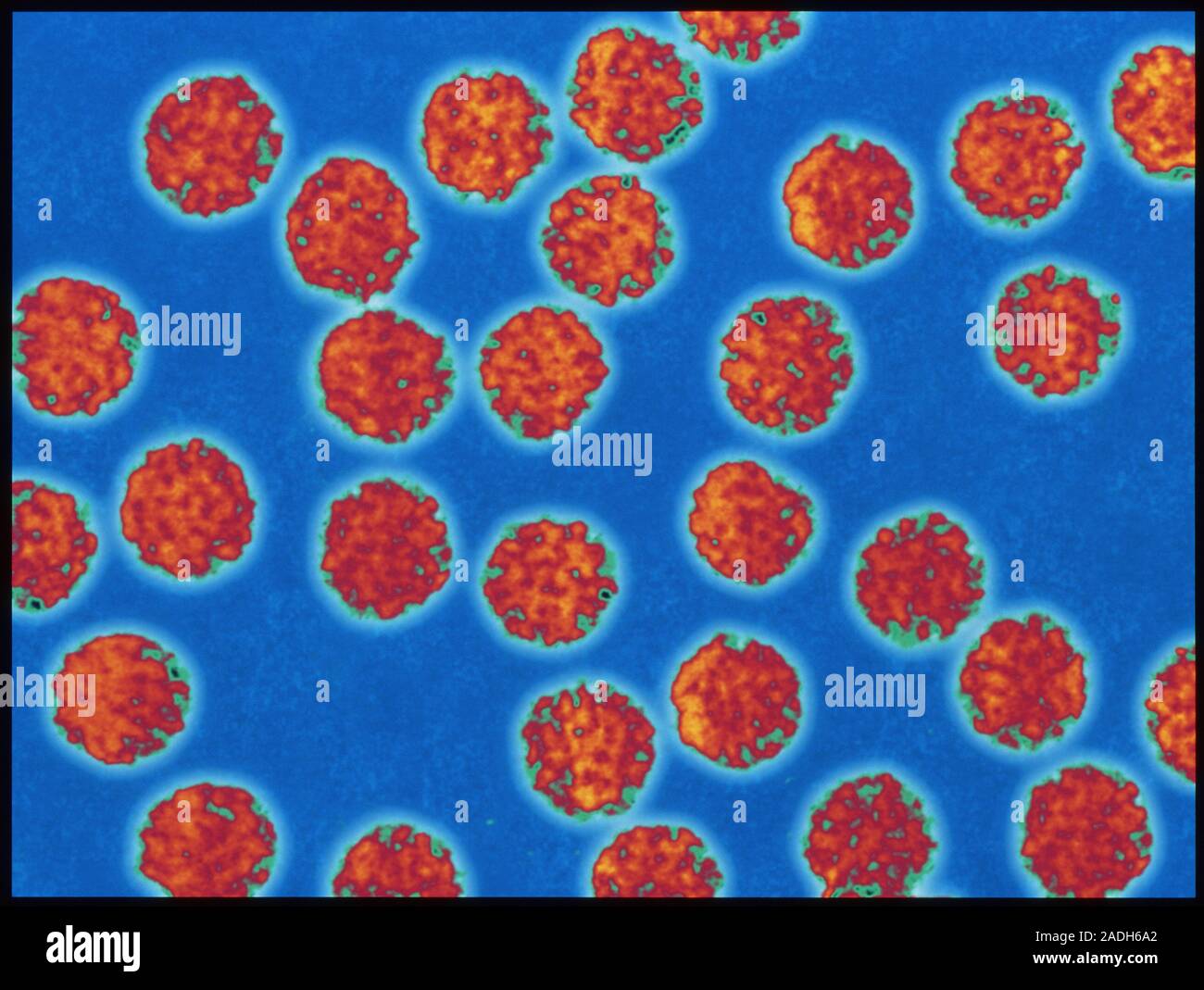 Hepatitis B virus. Coloured transmission electron micrograph (TEM) of ...