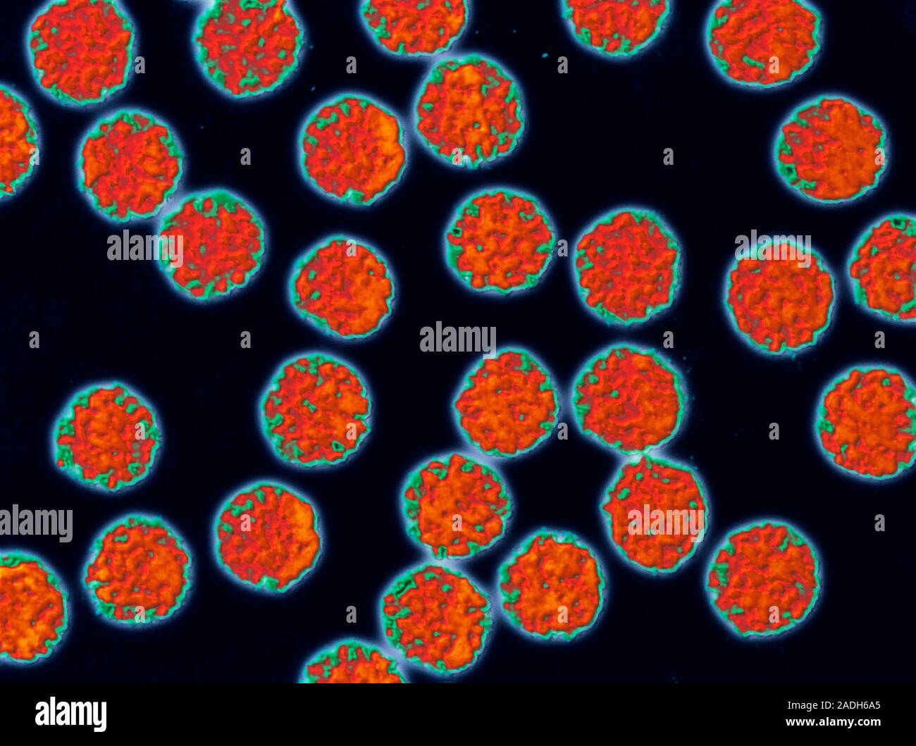 Hepatitis B virus. Coloured transmission electron micrograph (TEM) of ...