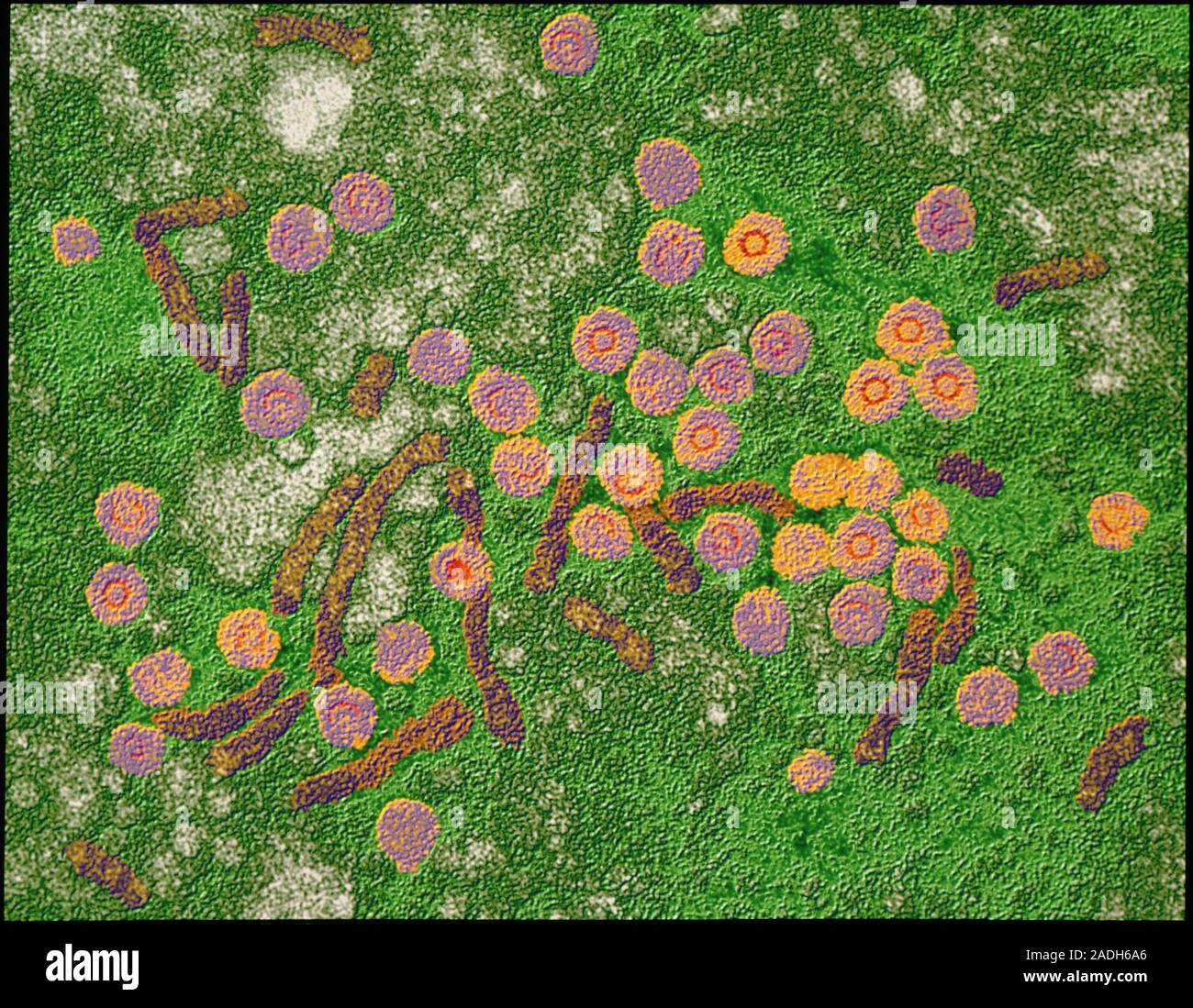 Hepatitis B virus. Transmission Electron Micrograph (TEM) of Hepatitis ...
