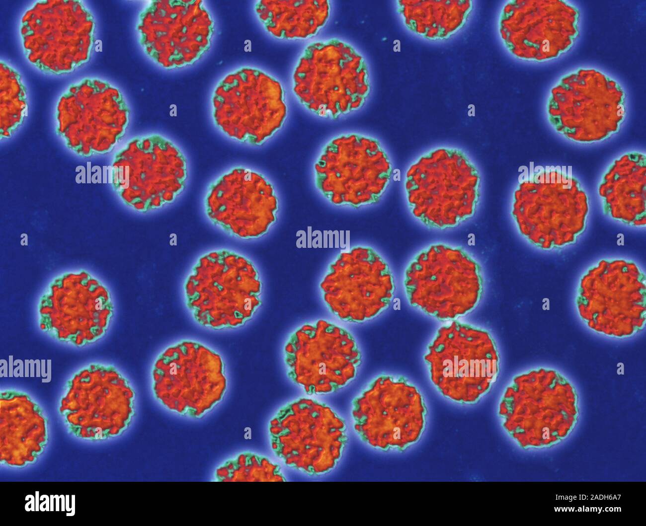 Hepatitis B virus. Coloured Transmission Electron Micrograph (TEM) of ...