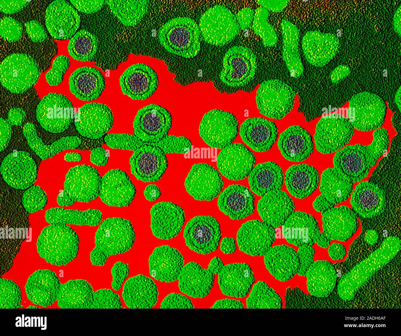 Hepatitis B virus. Coloured transmission electron micrograph (TEM) of ...