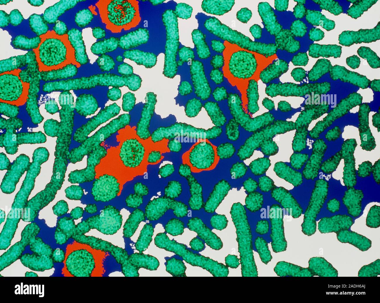 Hepatitis B viruses. Coloured transmission elect- ron micrograph (TEM ...