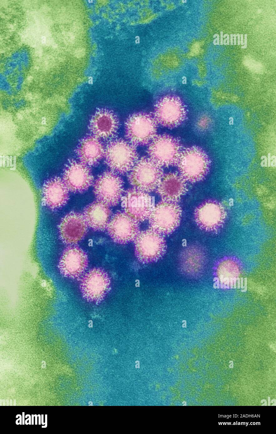 Hepatitis B virus. Coloured transmission electron micrograph (TEM) of ...