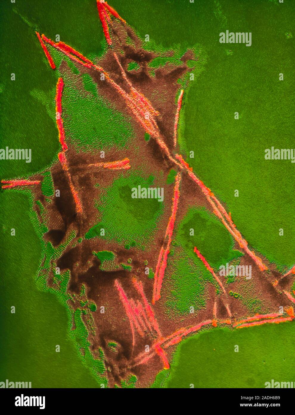Prions in mad cow" brain. Coloured Transmission Electron Micrograph ...
