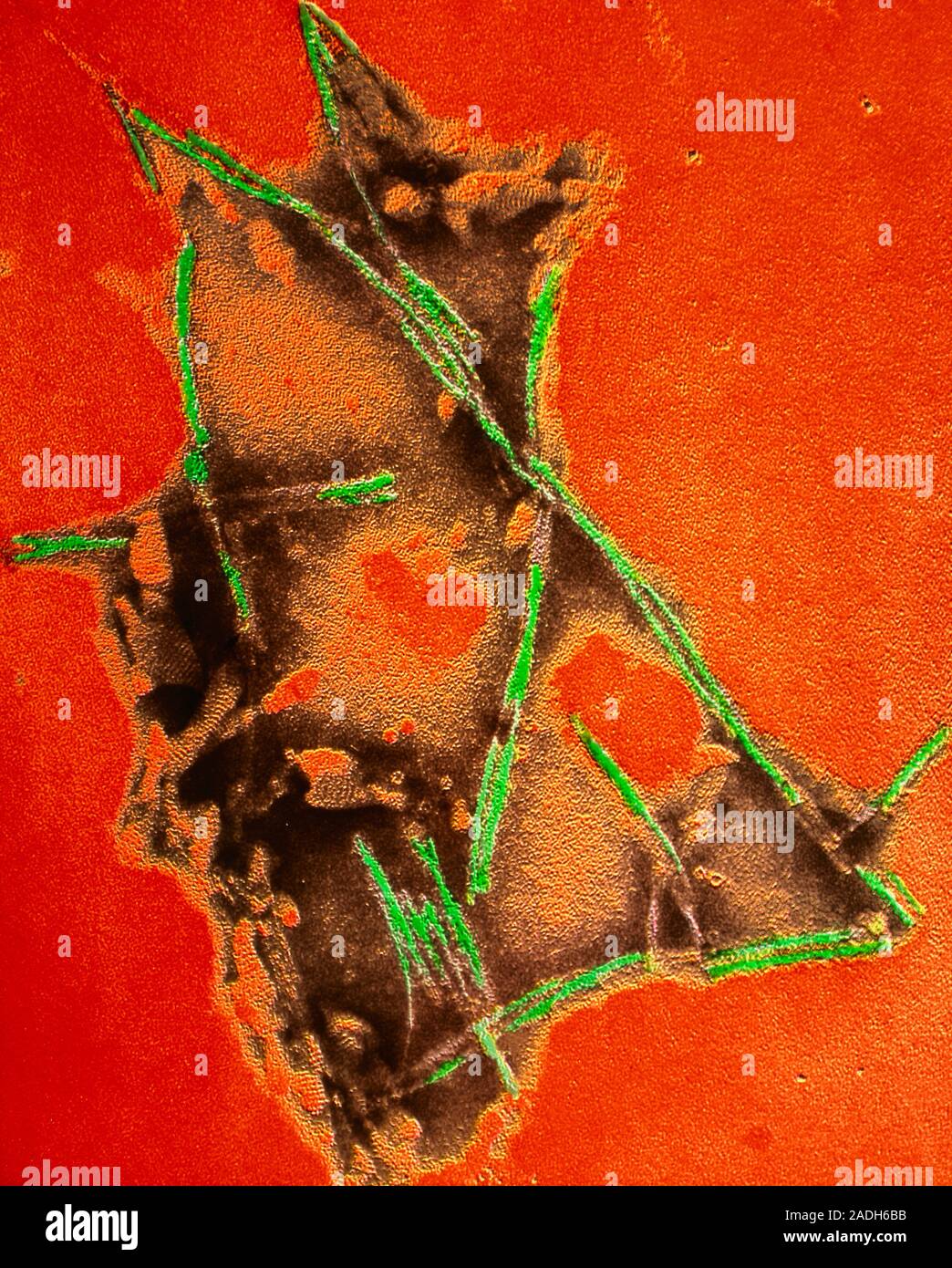Prions in mad cow" brain. Coloured Transmission Electron Micrograph ...