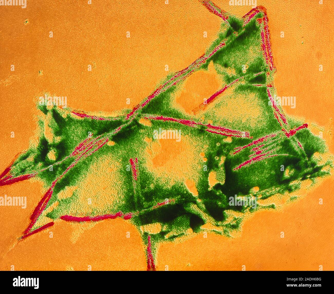 Prions in mad cow" brain. Coloured transmission electron micrograph ...