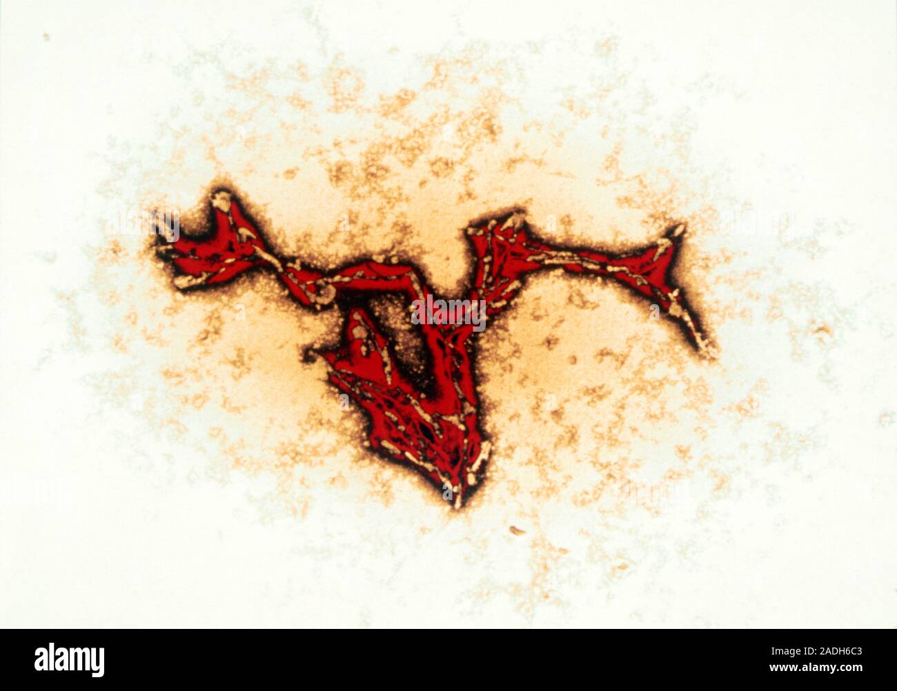 Prion protein. Coloured transmission electron micrograph (TEM) of prion ...