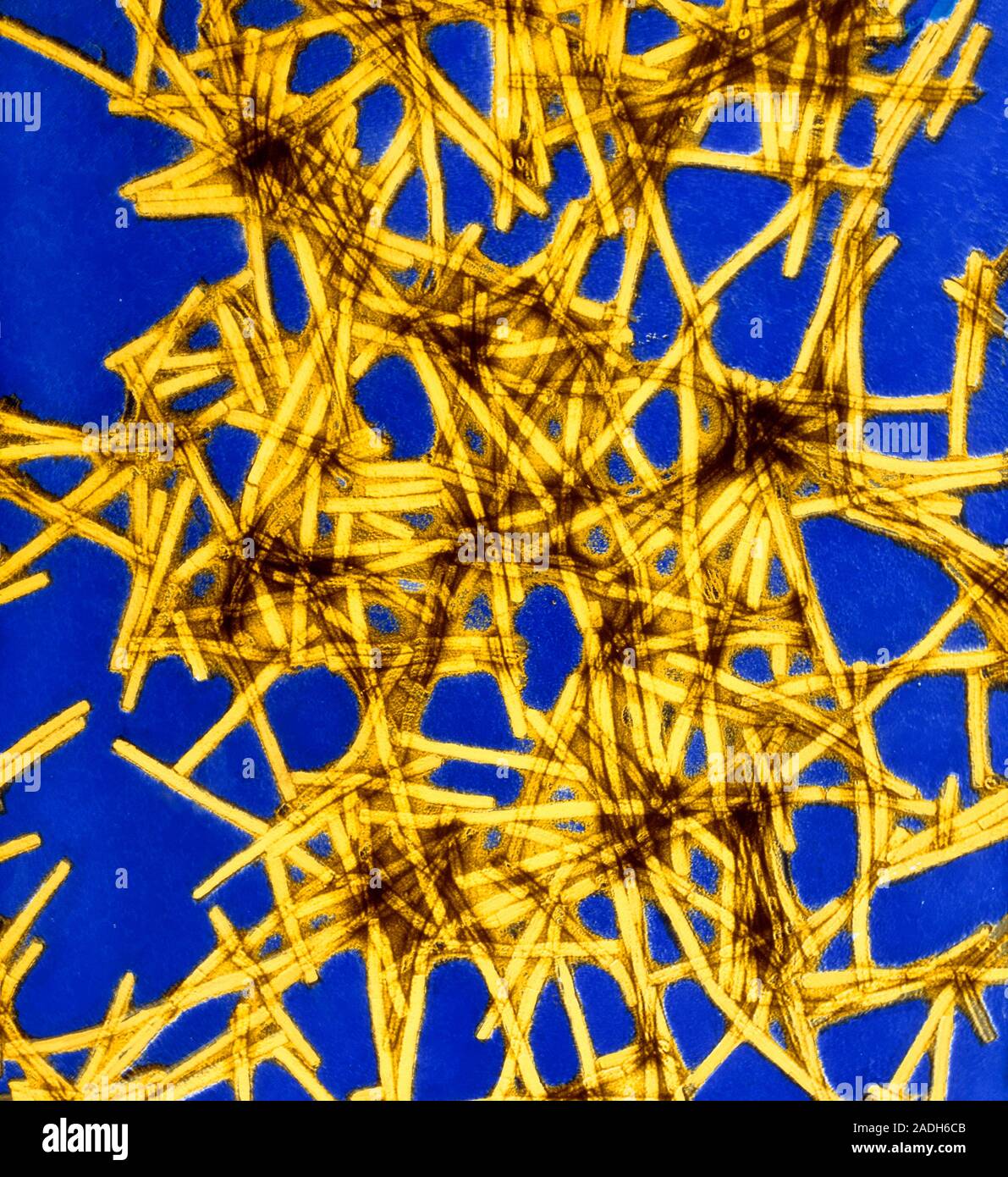 False-colour transmission electron micrograph of rod-shaped virus ...