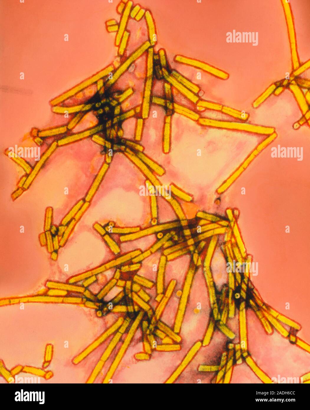 Tobacco mosaic viruses. Coloured transmission electron micrograph of a ...