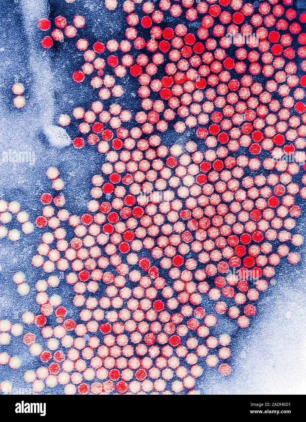 Arabis mosaic virus. Coloured transmission electron micrograph (TEM) of ...