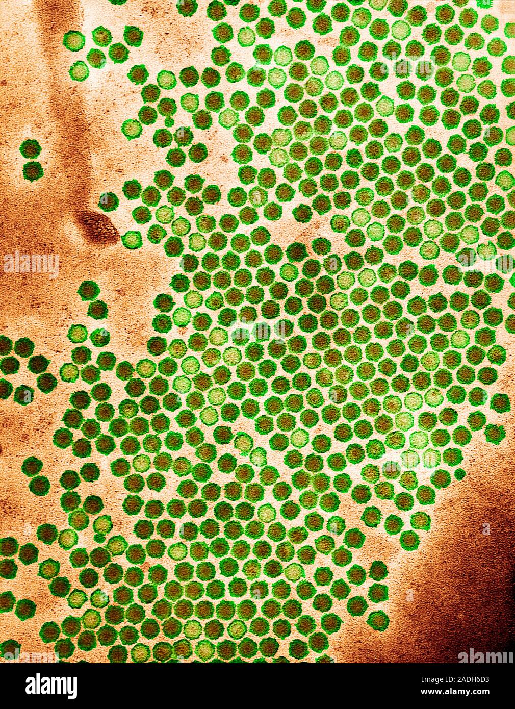 Arabis mosaic virus. Coloured transmission electron micrograph (TEM) of ...