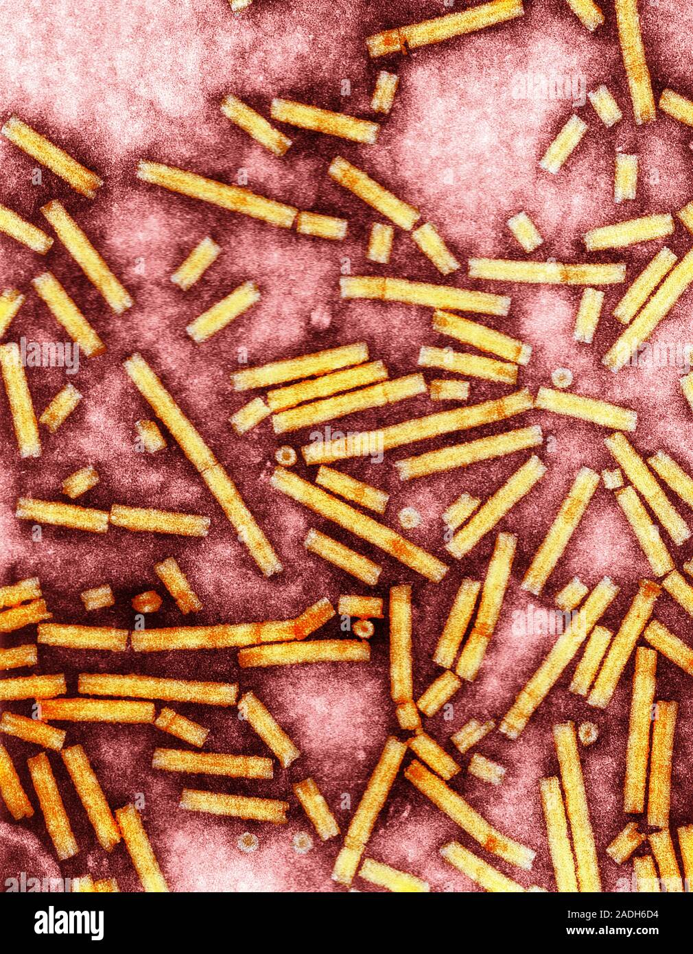 Barley stripe mosaic virus. Coloured transmission electron micrograph ...