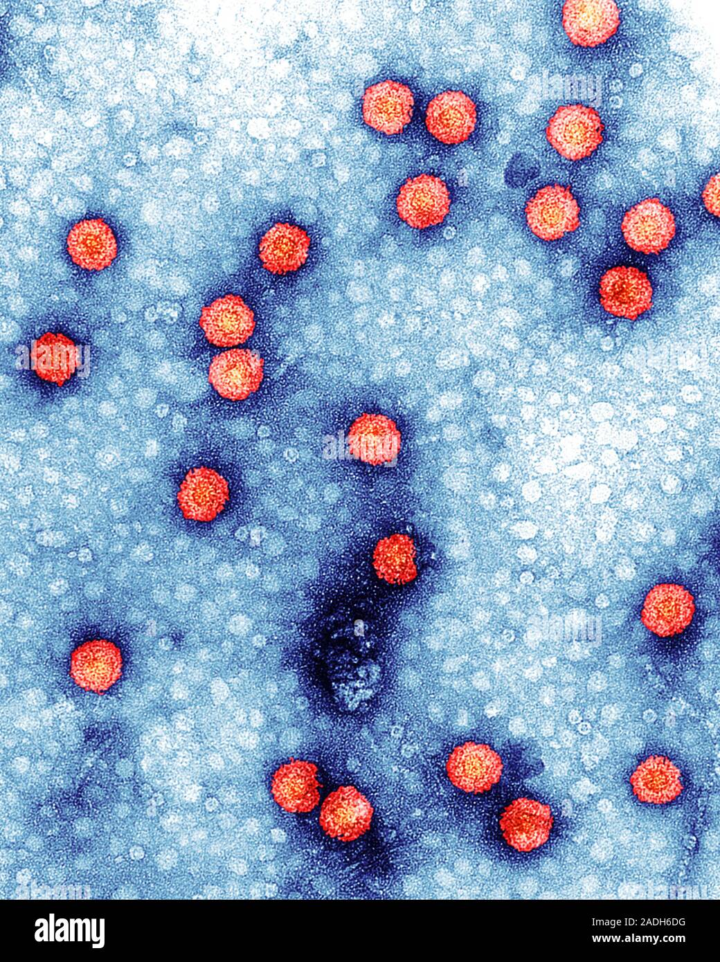 Cauliflower mosaic virus. Coloured transmission electron micrograph (TEM) of virus particles ...