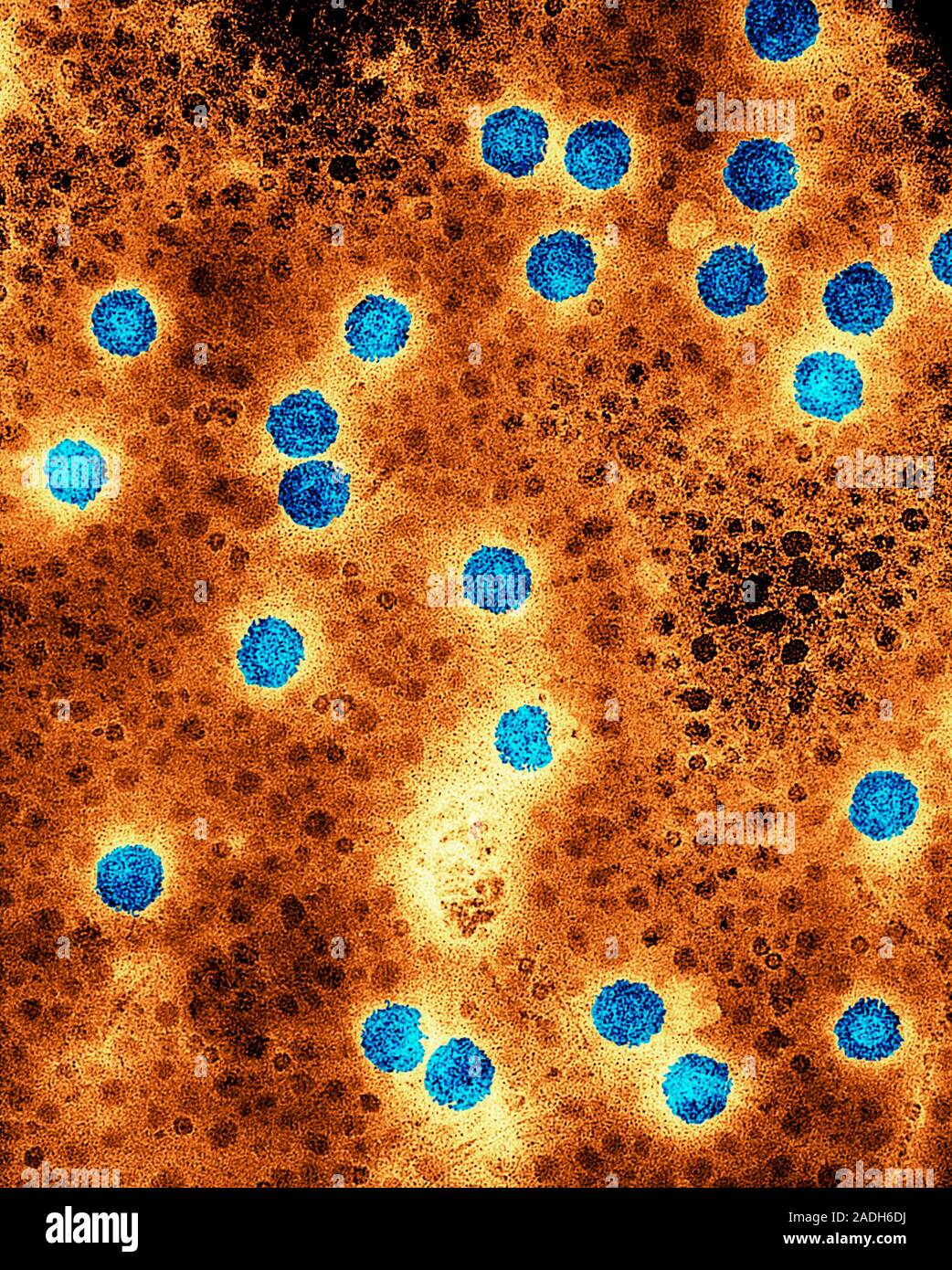 Cauliflower mosaic virus. Coloured transmission electron micrograph (TEM) of virus particles ...