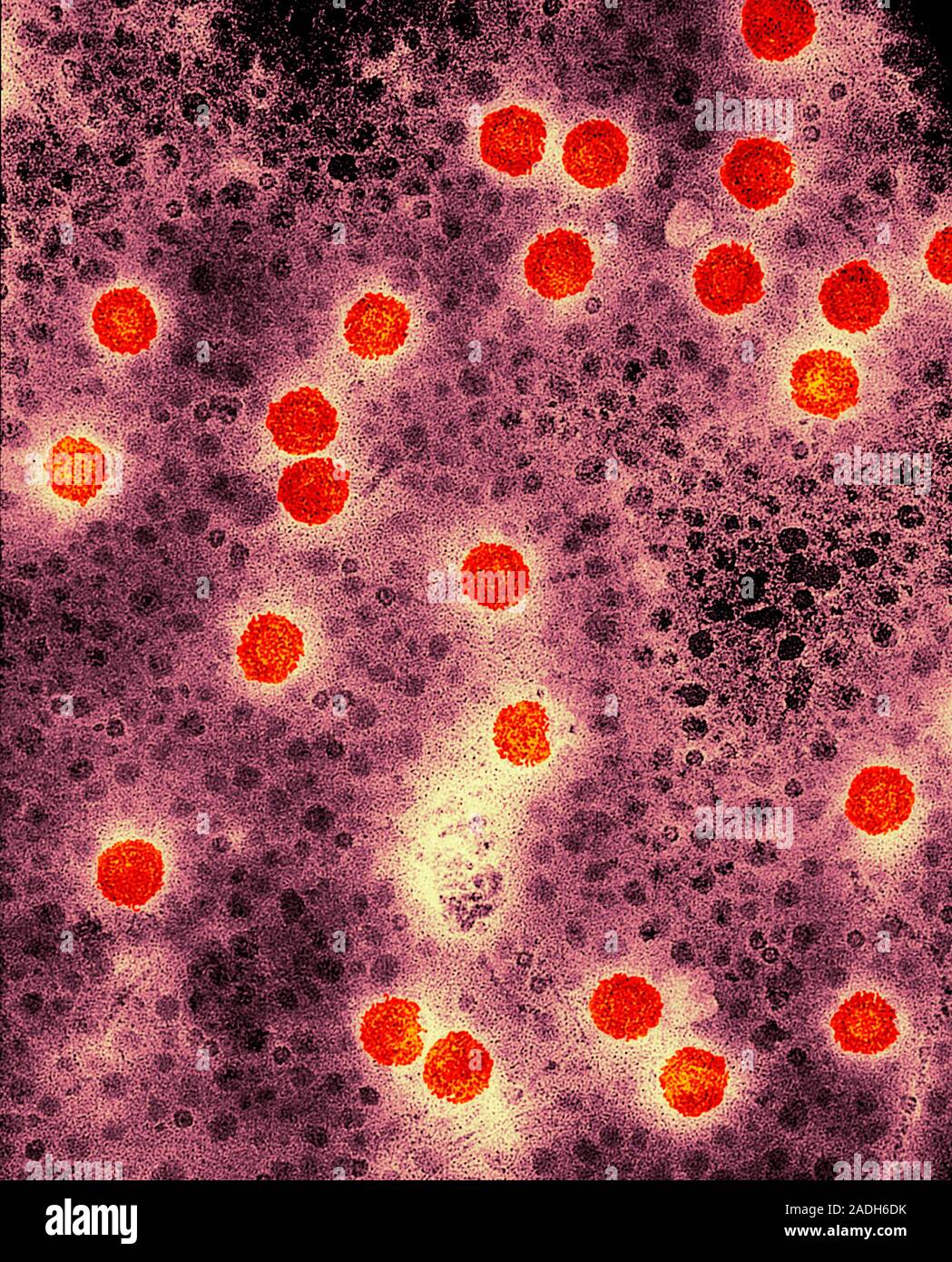 Cauliflower mosaic virus. Coloured transmission electron micrograph ...