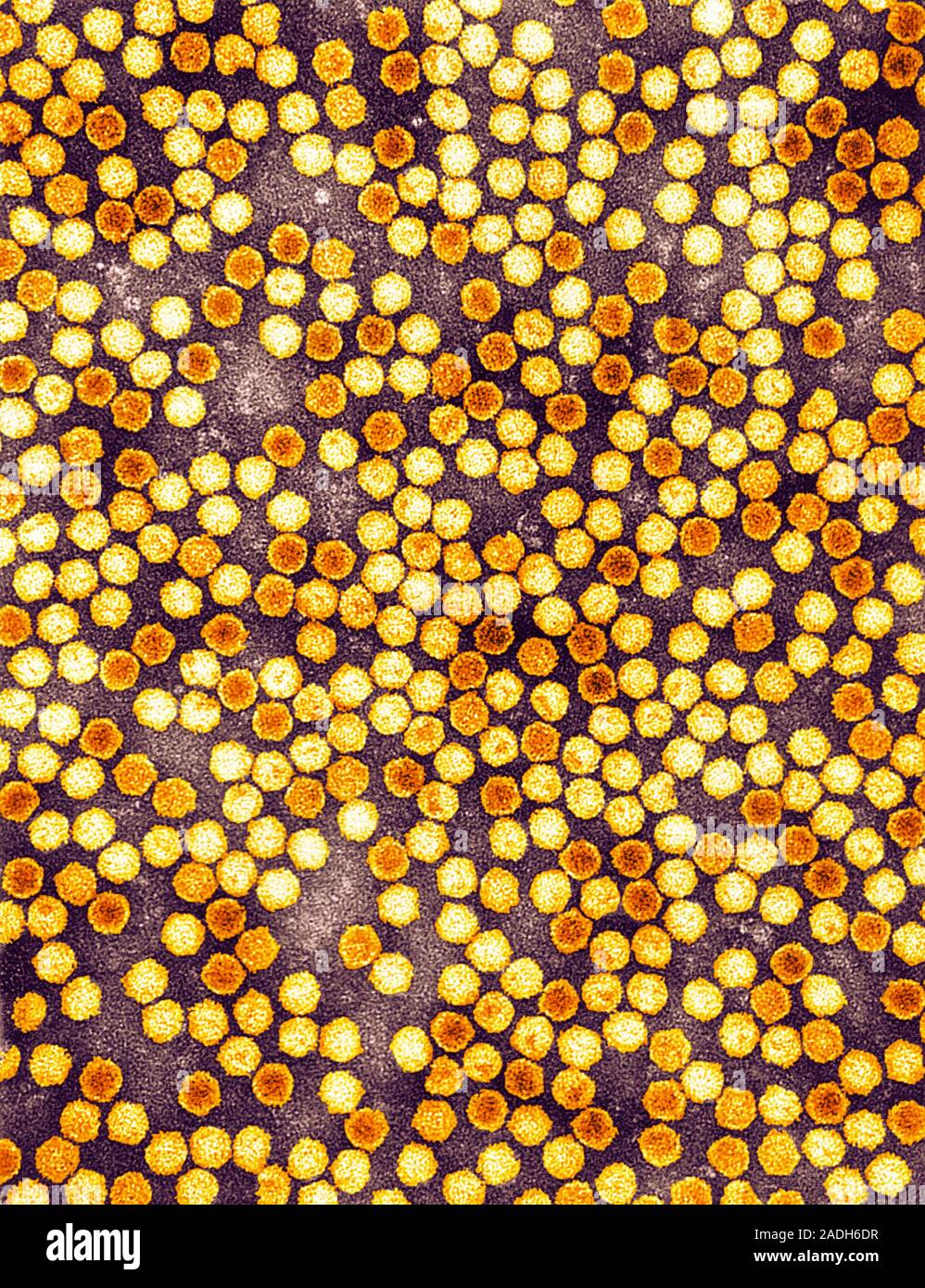 Cocksfoot mottle virus. Coloured transmission electron micrograph (TEM ...