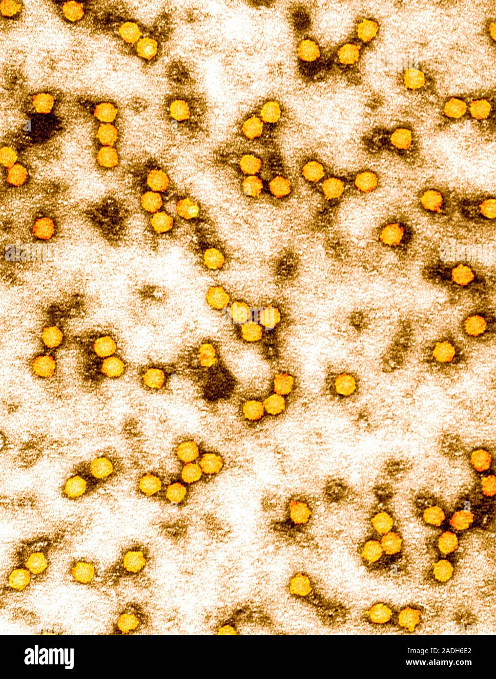 Maize chlorotic dwarf virus. Coloured transmission electron micrograph ...