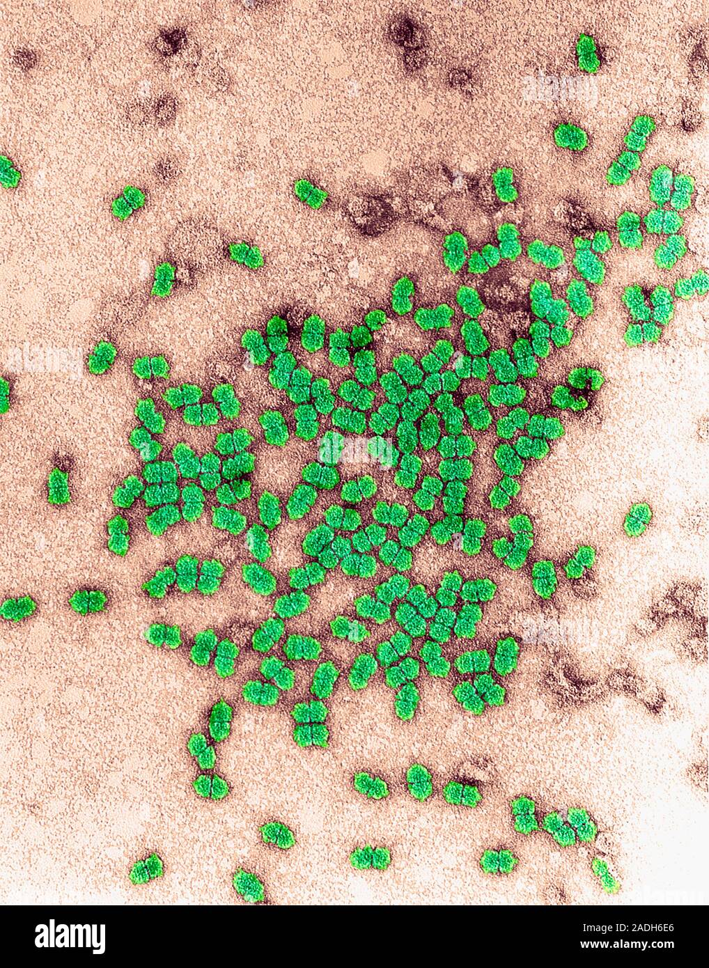 Maize streak virus. Coloured transmission electron micrograph (TEM) of ...