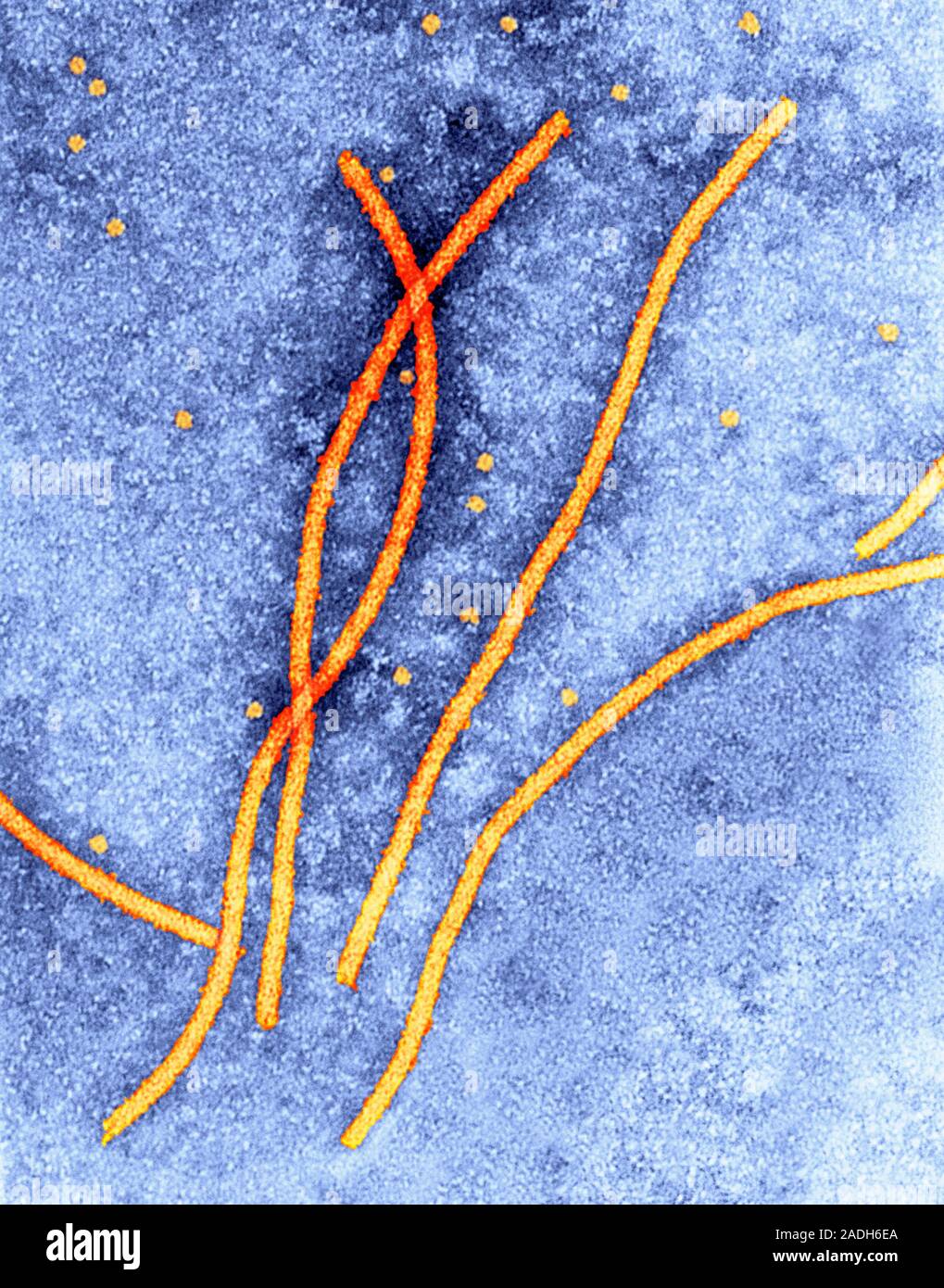 Potato Y virus. Coloured transmission electron micrograph (TEM) of ...