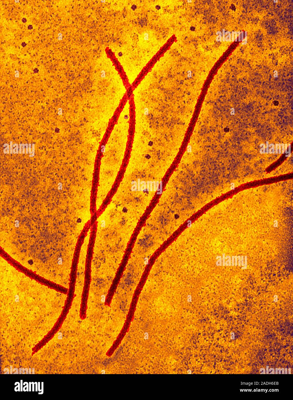 Potato Y virus. Coloured transmission electron micrograph (TEM) of ...