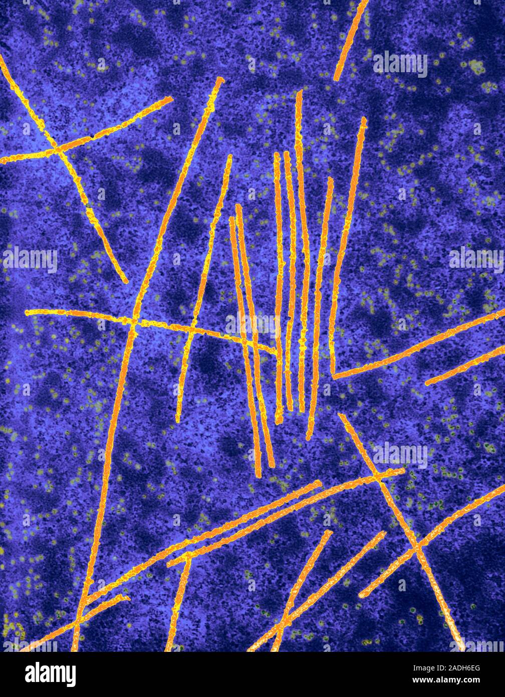 Red clover vein mosaic virus. Coloured transmission electron micrograph ...