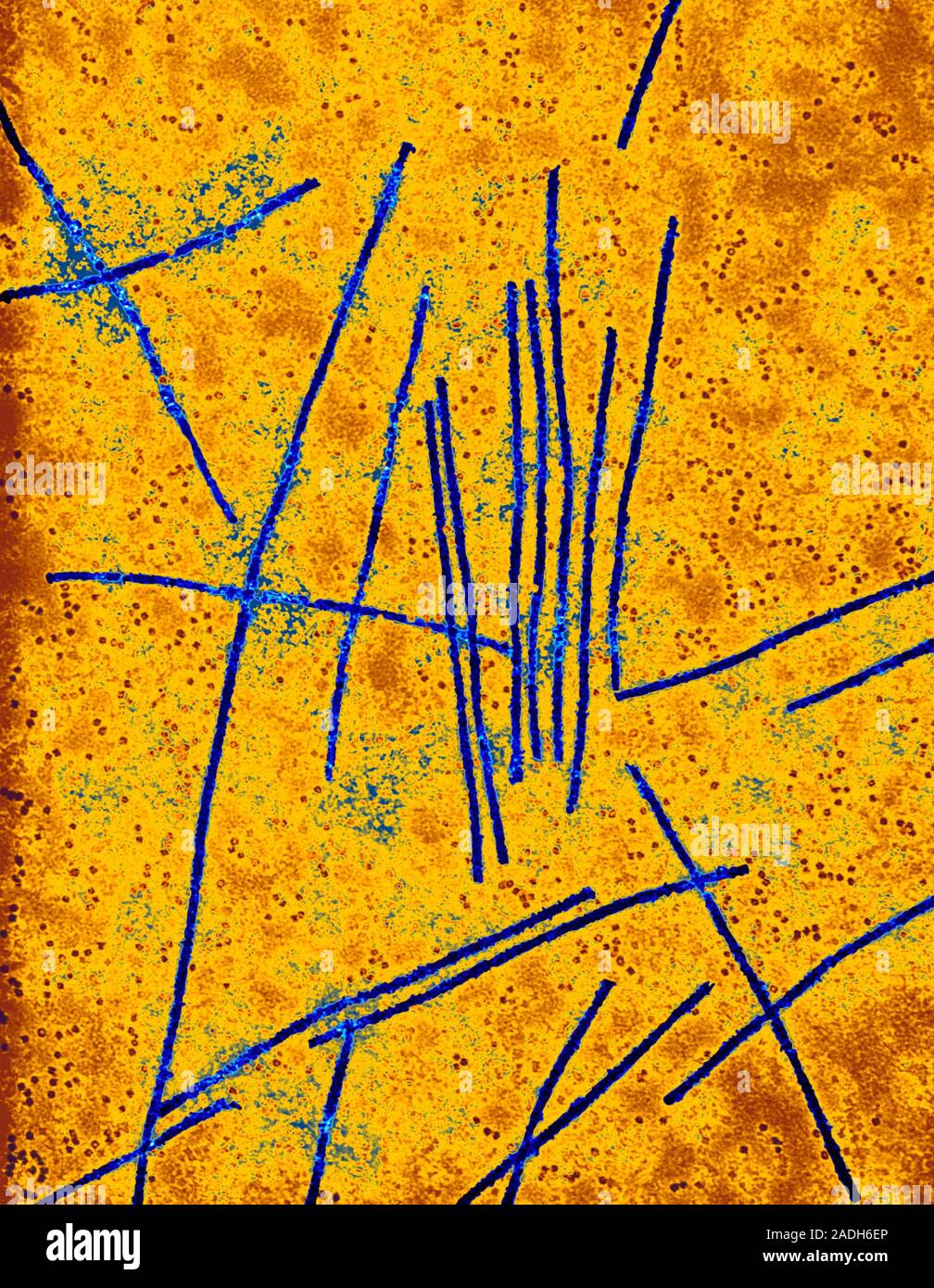 Red clover vein mosaic virus. Coloured transmission electron micrograph ...