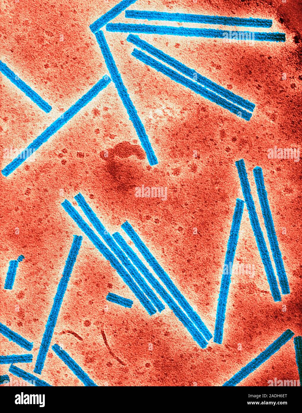 Tobacco mosaic virus. Coloured transmission electron micrograph (TEM ...
