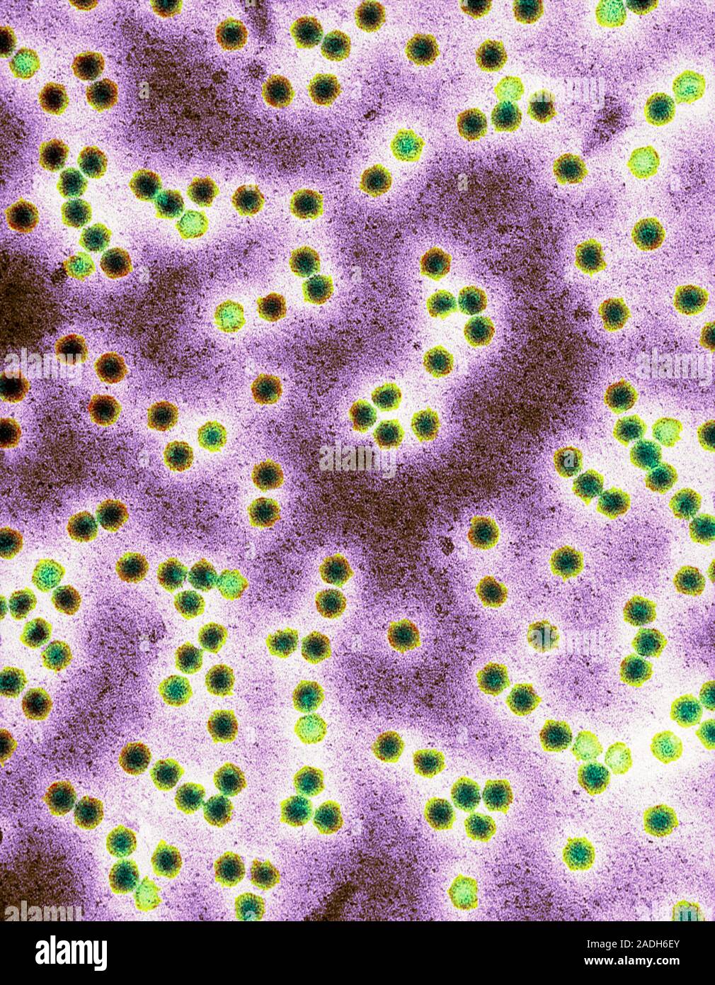 Tobacco necrosis virus. Coloured transmission electron micrograph (TEM) of virus particles ...