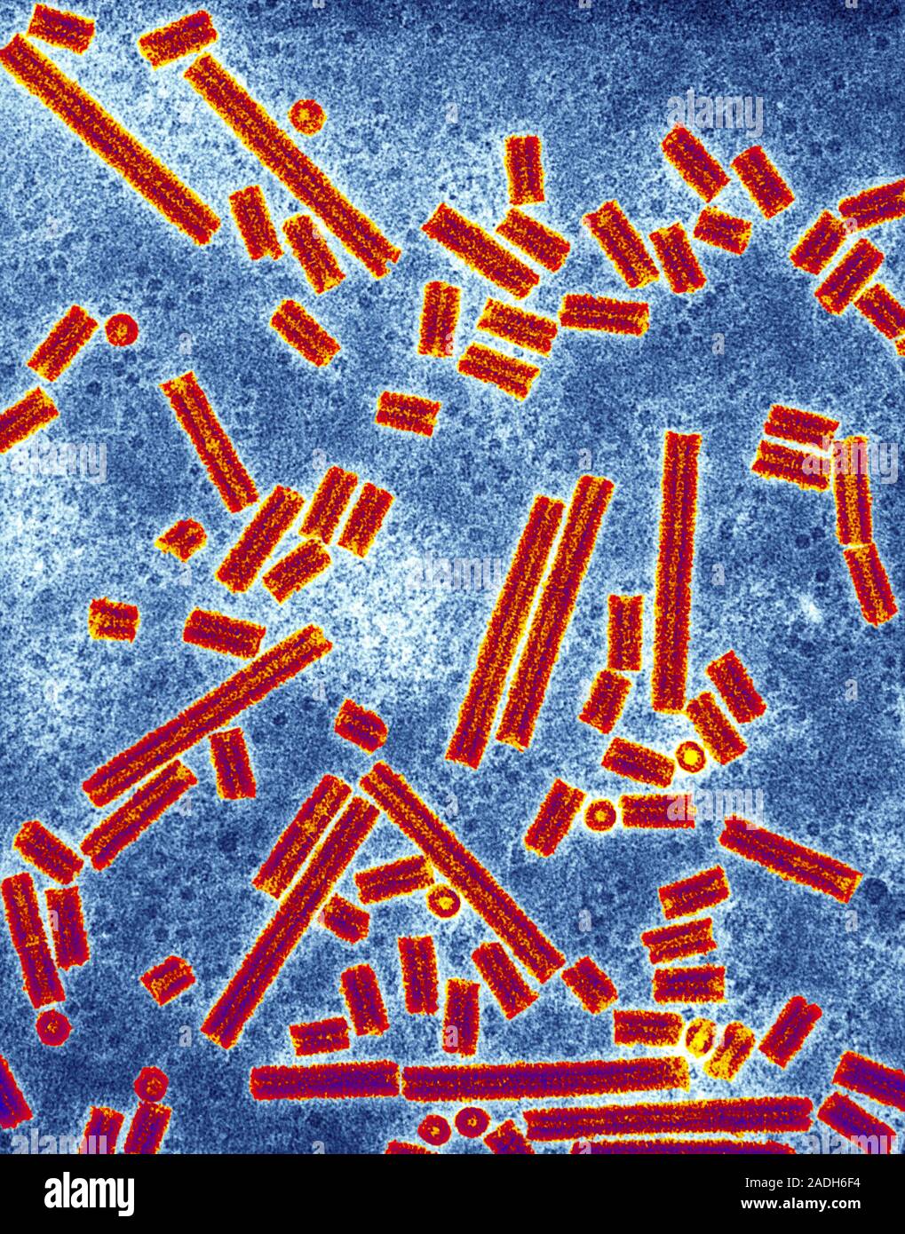 Tobacco rattle virus. Coloured transmission electron micrograph (TEM ...