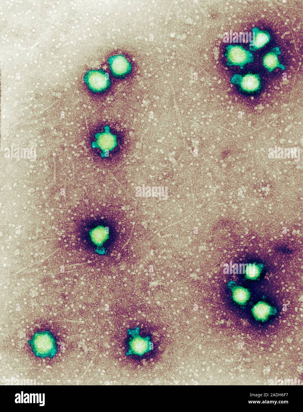 Tomato spotted wilt virus. Coloured transmission electron micrograph ...