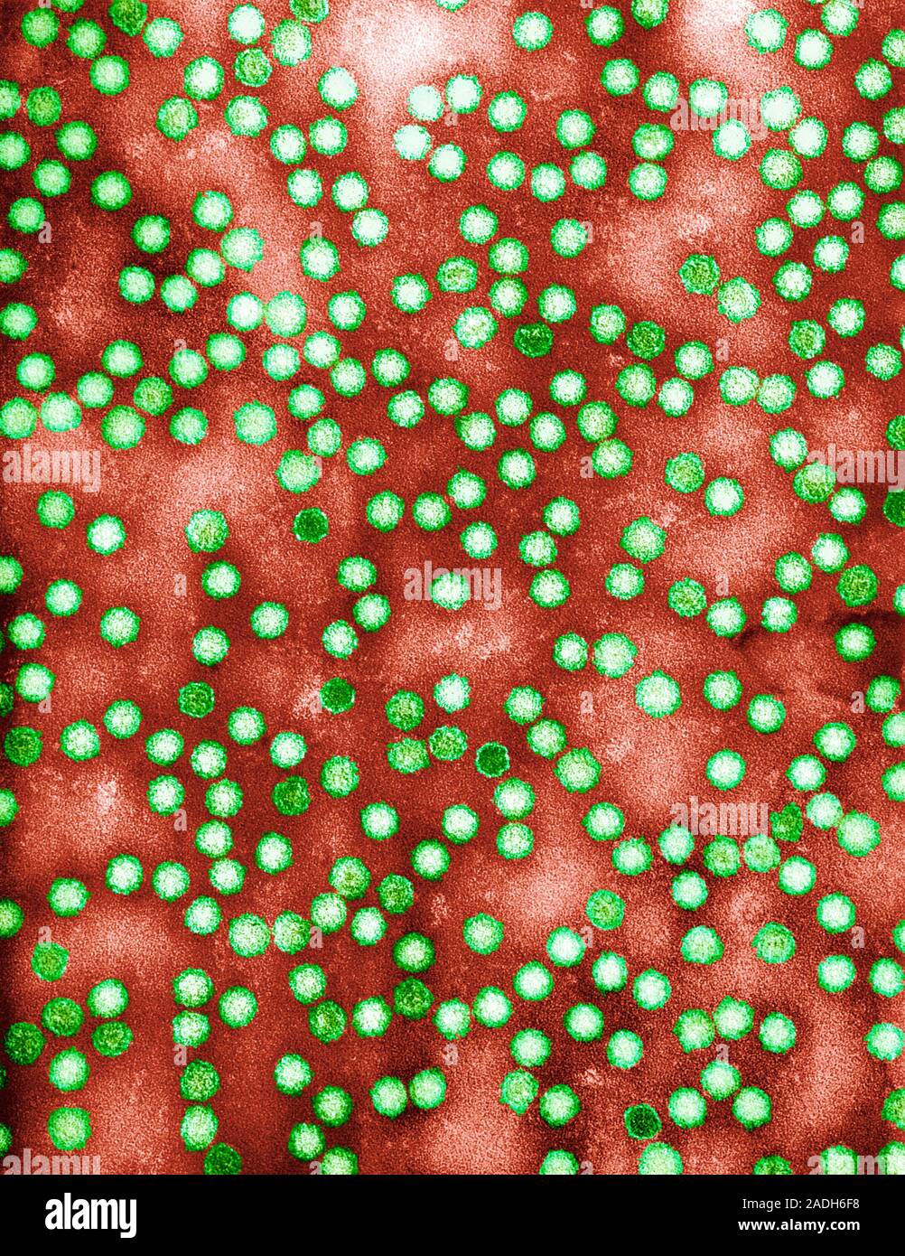 Turnip yellow mosaic virus. Coloured transmission electron micrograph ...