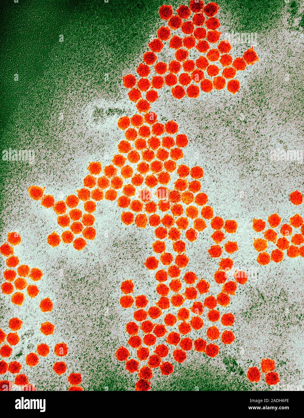 Beet mild yellowing virus. Coloured transmission electron micrograph ...