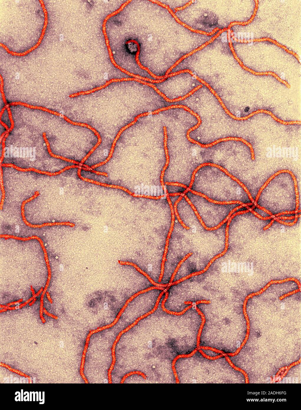 Beet yellows virus. Coloured transmission electron micrograph (TEM) of ...