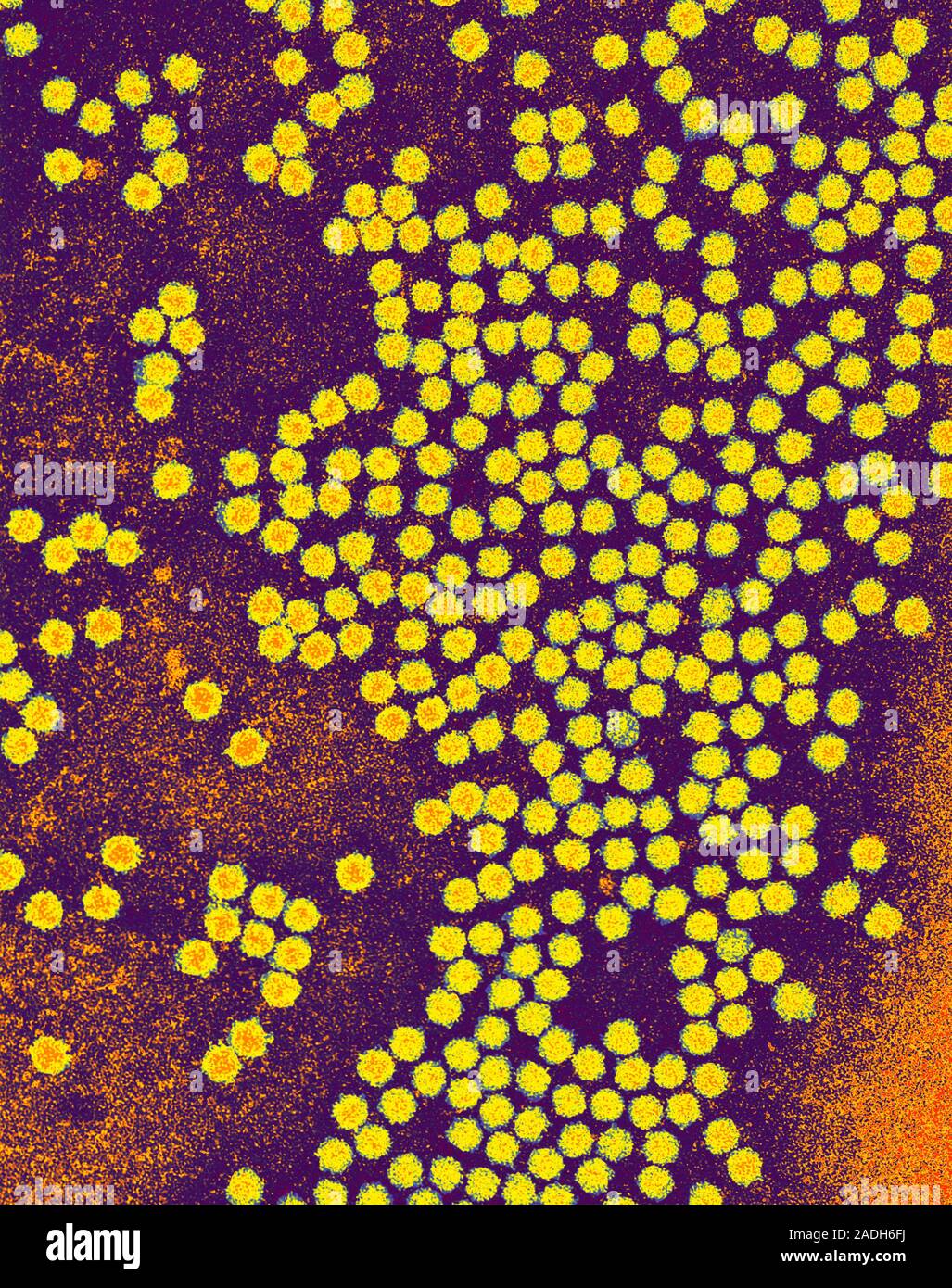 Broad bean wilt virus. Coloured transmission electron micrograph (TEM ...