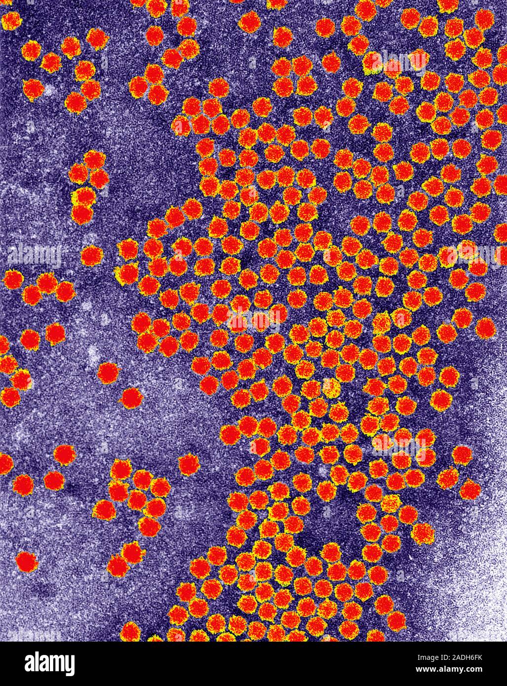 Broad bean wilt virus. Coloured transmission electron micrograph (TEM ...