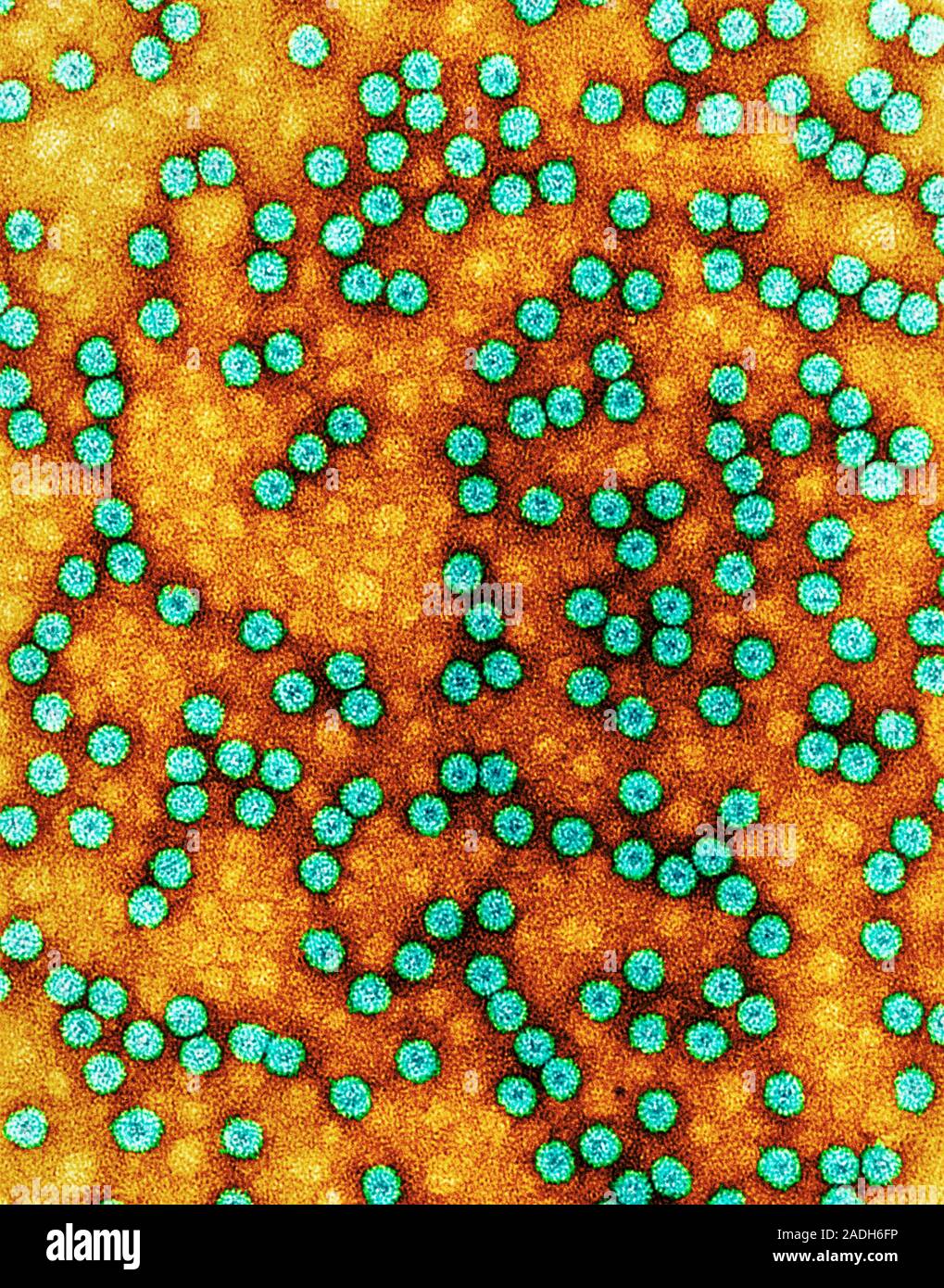 Brome grass mosaic virus. Coloured transmission electron micrograph ...