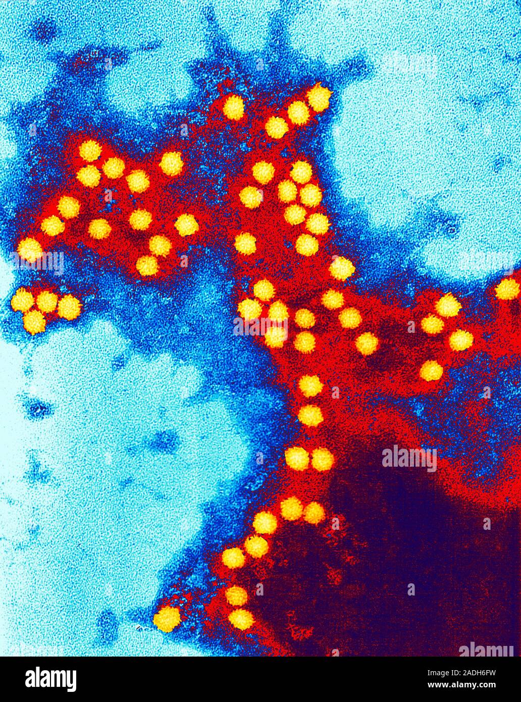 Carnation mottle virus. Coloured transmission electron micrograph (TEM ...