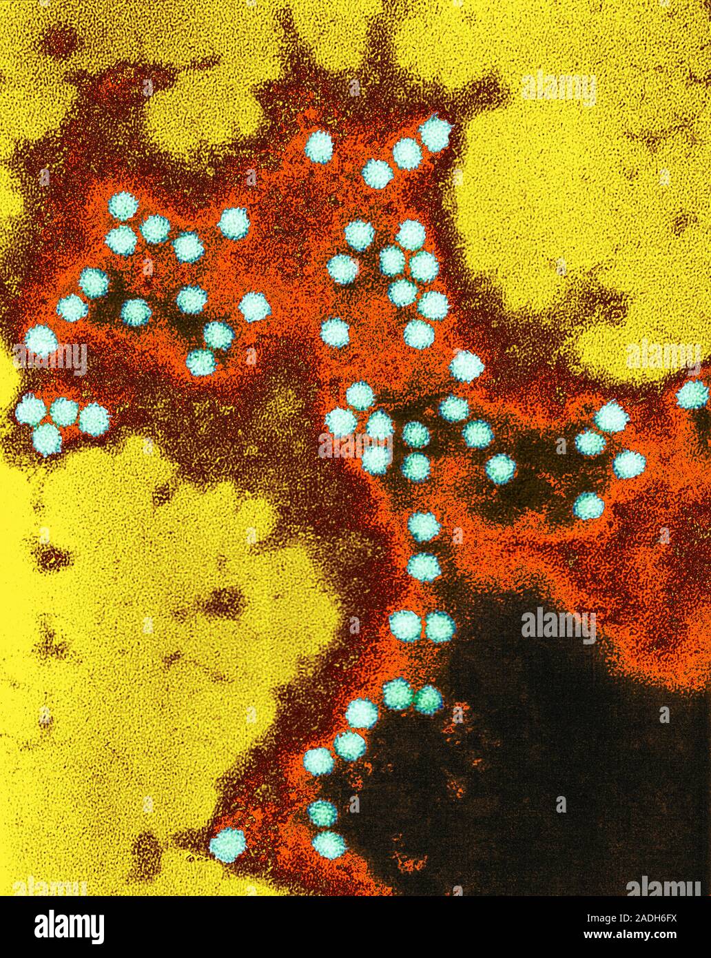 Carnation mottle virus. Coloured transmission electron micrograph (TEM ...
